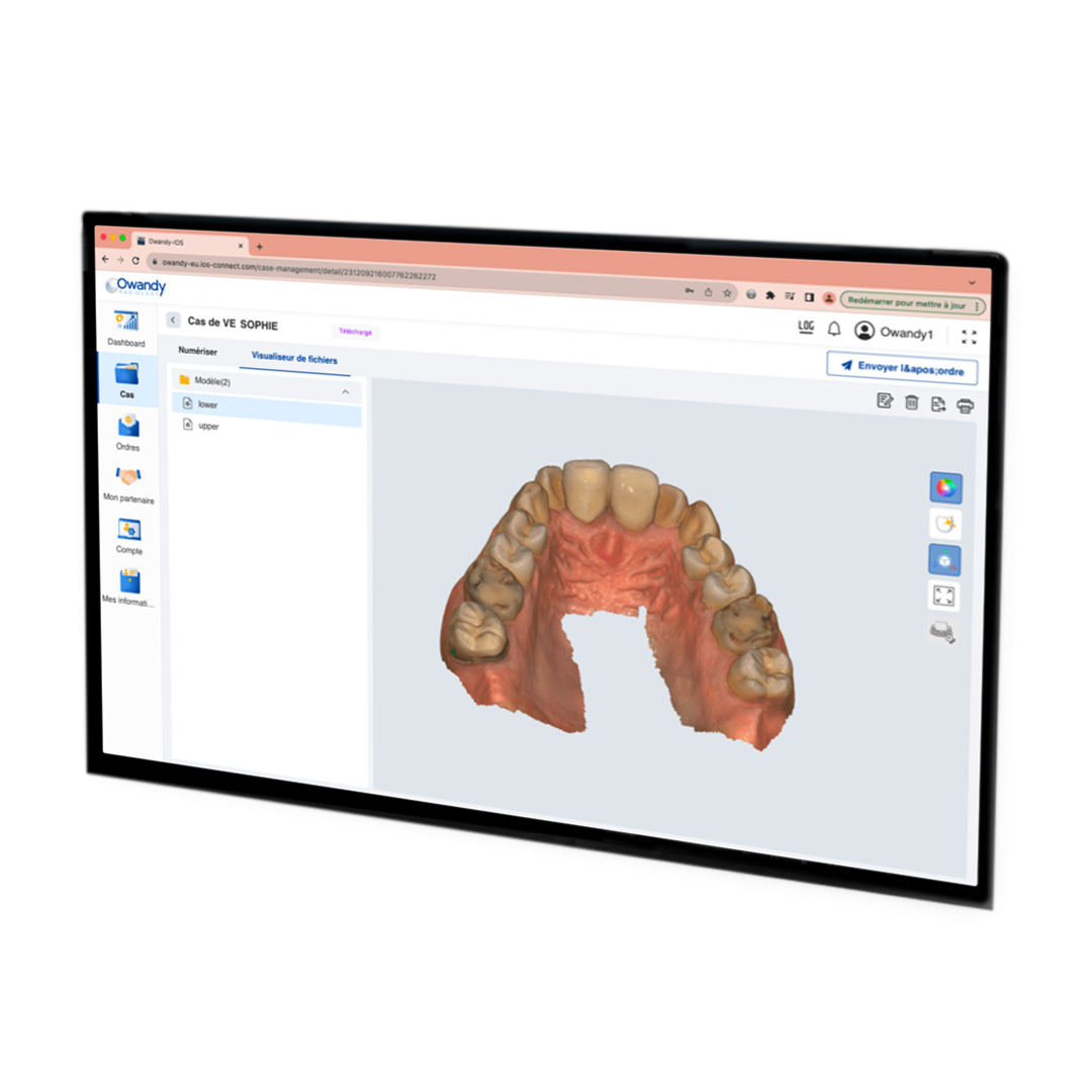 Presentation of Owandy IOS | The intraoral 3D scanner