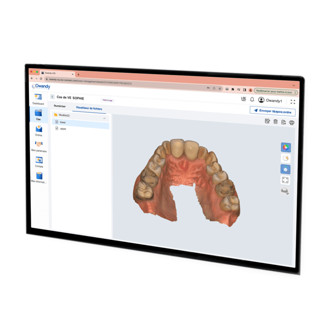 Presentation of Owandy IOS | The intraoral 3D scanner